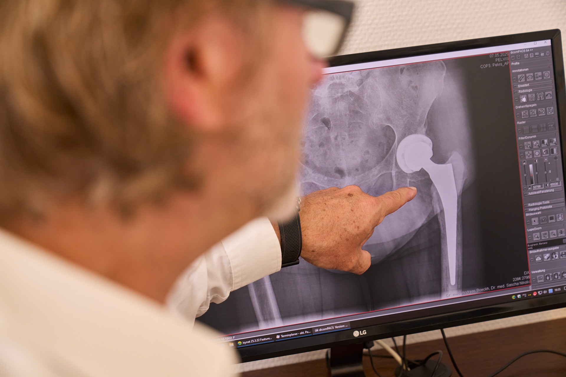 Hüft-OP-TEP - Orthopädische Gemeinschaftspraxis MedNord
